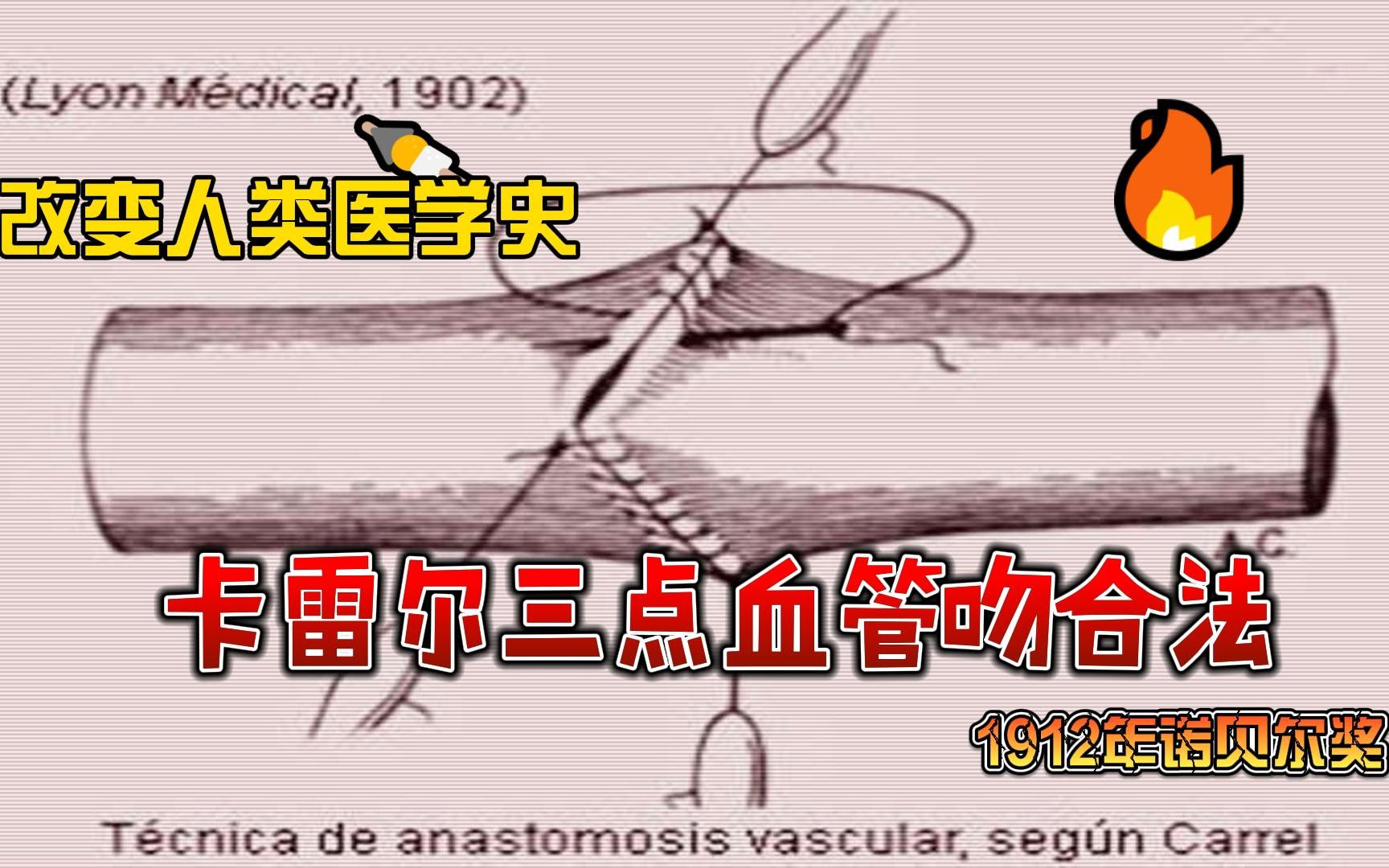 【卡雷尔三点血管吻合法】改变人类医学史 | 1912年诺贝尔奖