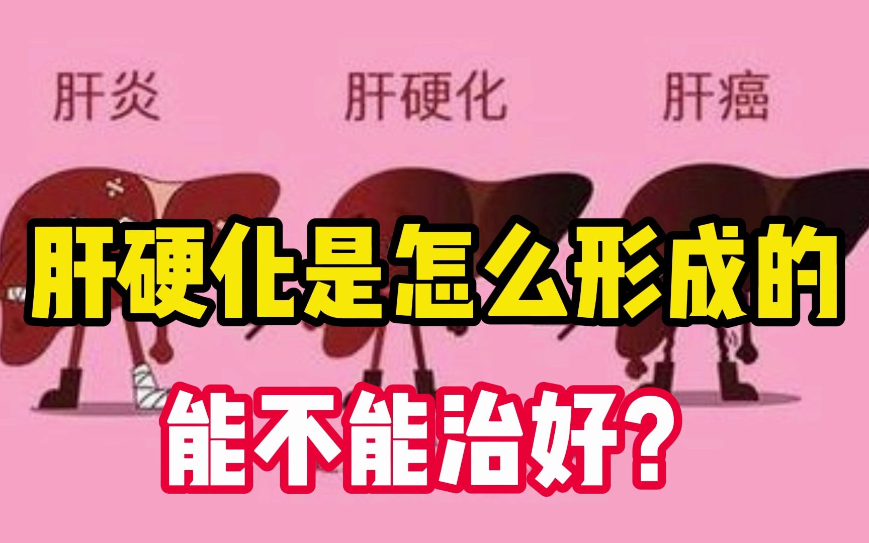肝硬化是怎么形成的?能不能治好?
