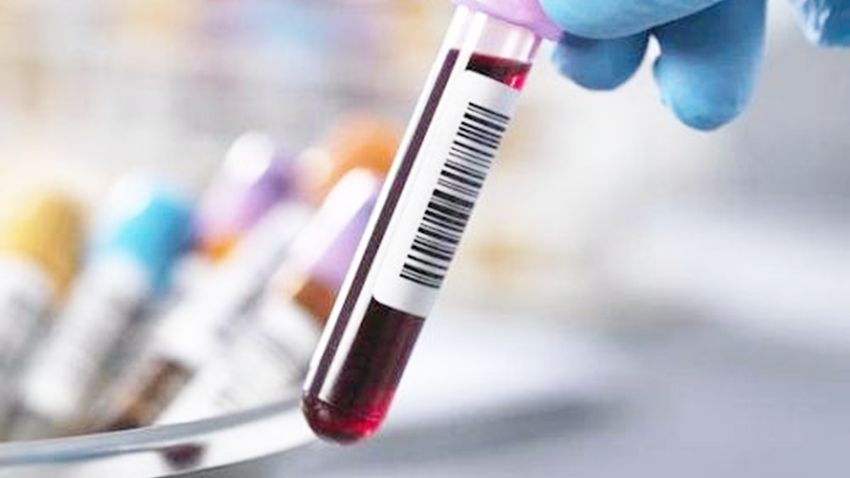 什么是熊猫血,拥有熊猫血是怎样一种感受?看完长知识了