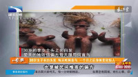 30岁女子长白发,吃何首乌1个月后,身体变化惊人
