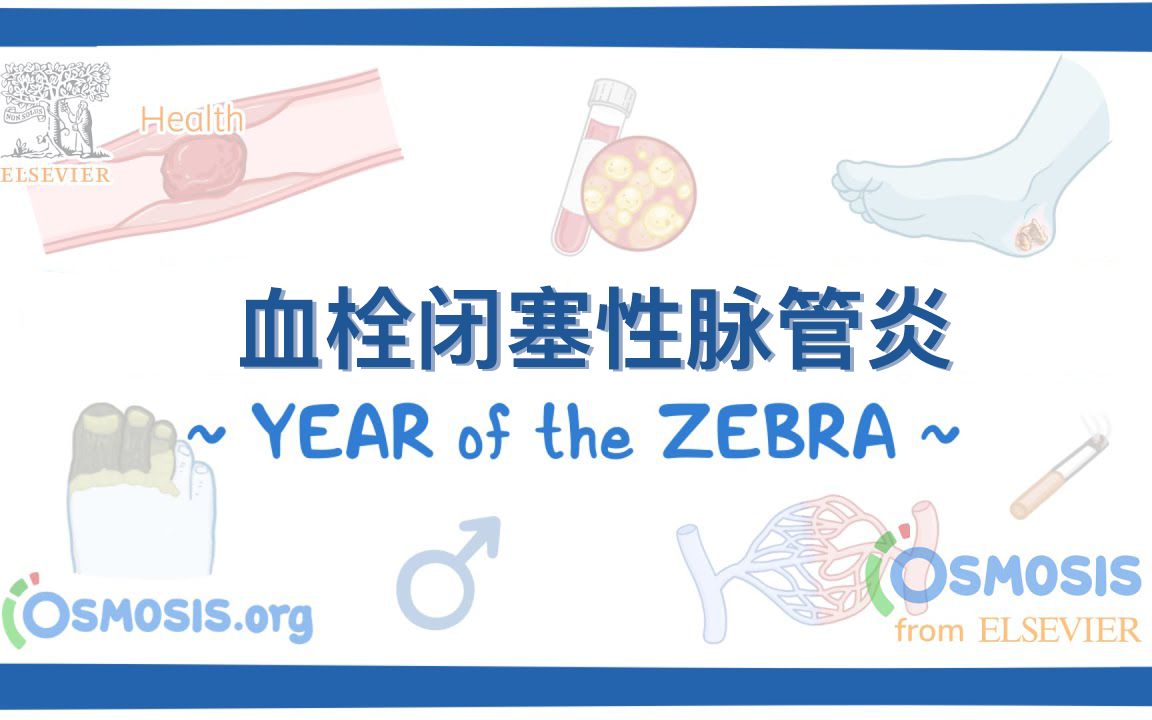 血栓闭塞性脉管炎:让四肢疼痛难耐的疾病,最大危险因素是吸烟