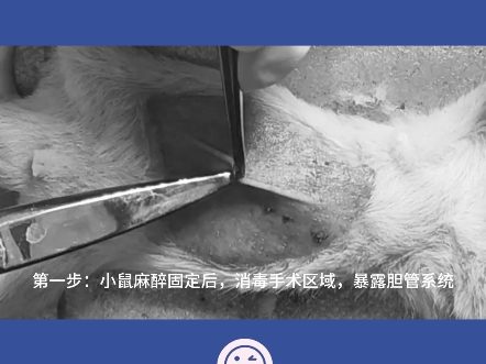 实验干货丨胆管梗阻模型