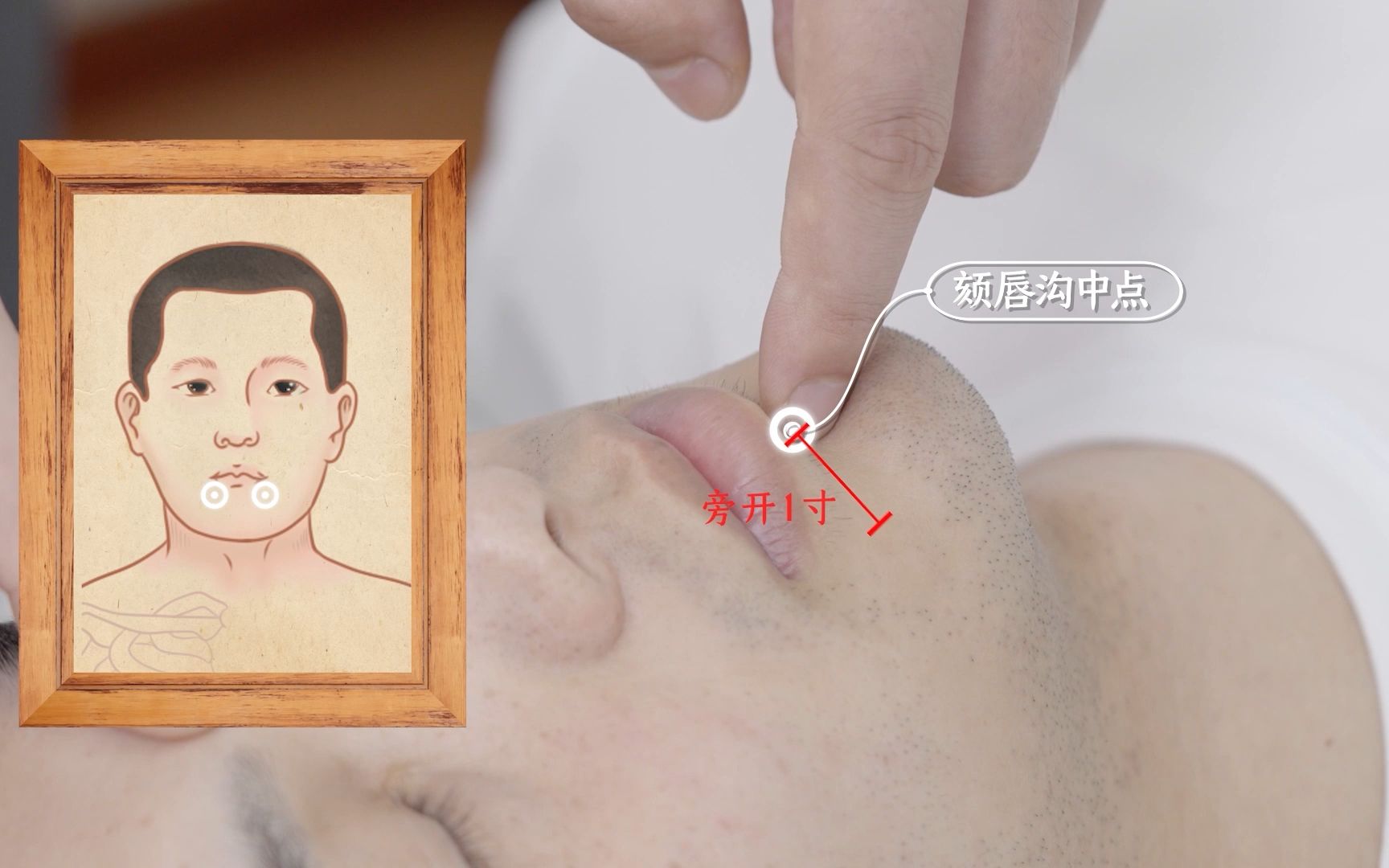 经外奇穴-夹承浆