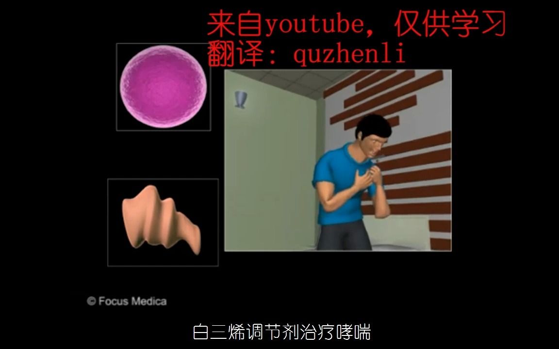 白三烯调节剂,治疗哮喘新型药物
