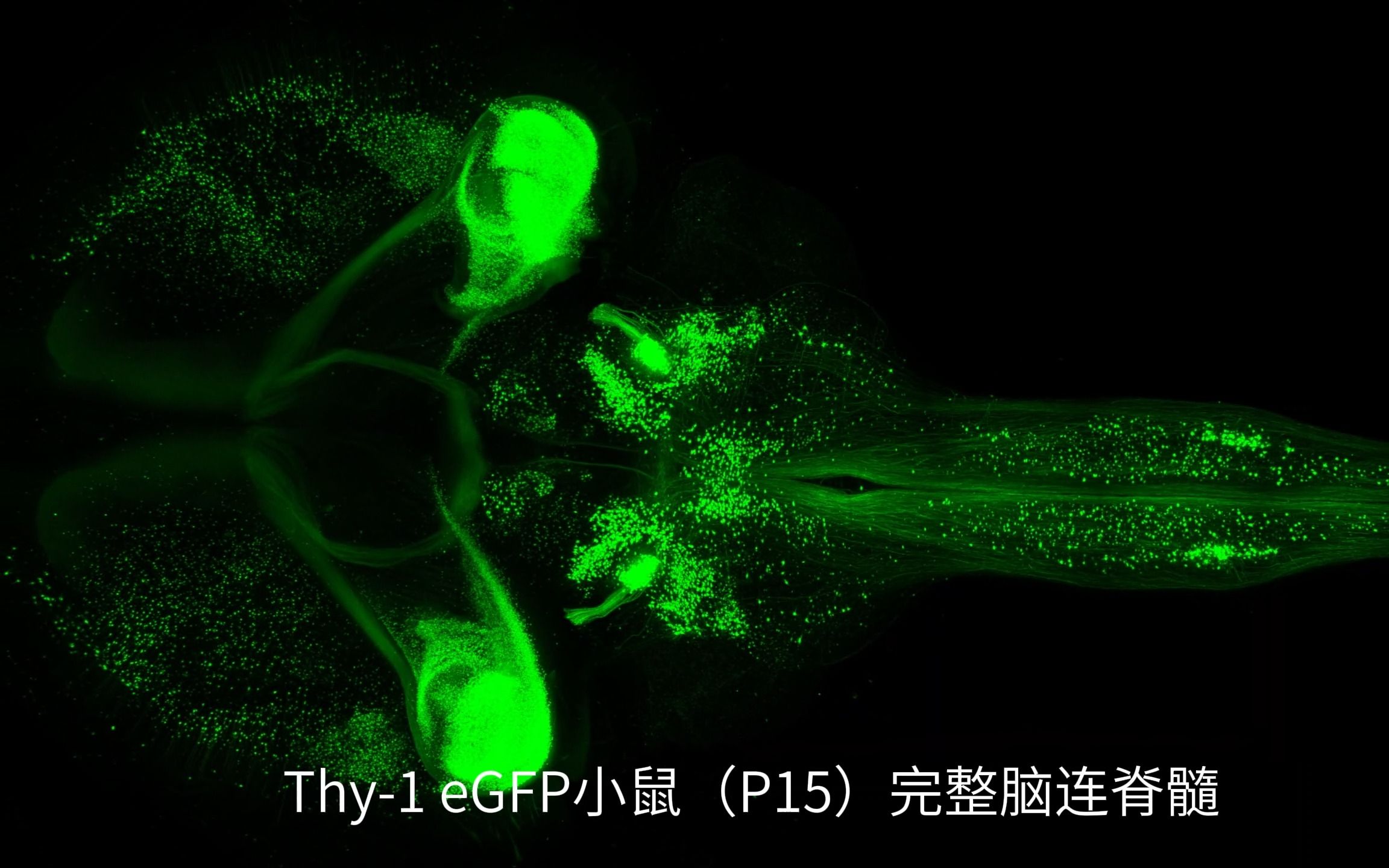 ...显微镜3D荧光成像,神经方向应用合集,小鼠全脑、脑连脊髓等大组织...