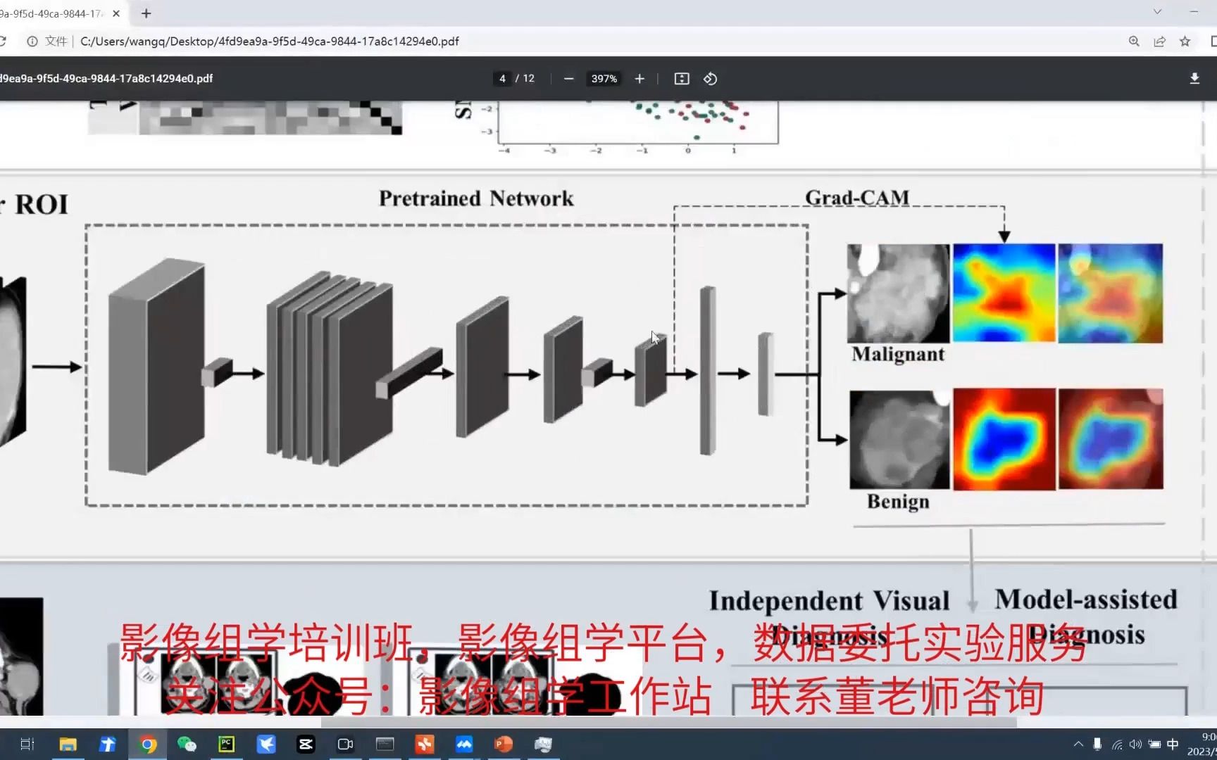 乳腺癌影像组学MRI图像的乳腺癌分割:一种基于3D迁移学习的方法