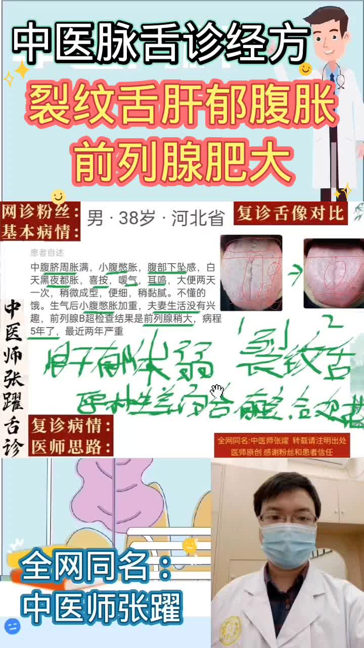 简单舌诊案例三 肝郁腹胀裂纹舌 中医师张躍舌诊竖版5.13