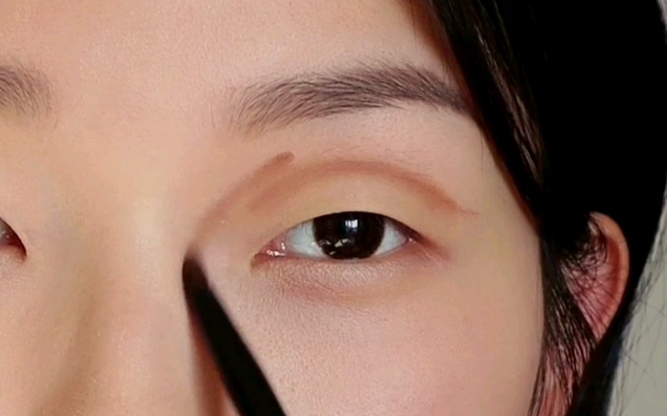 肿眼泡又肿又没深怎么办?一招教会你