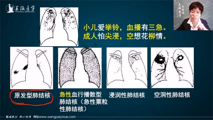 肺结核传染性有多强?被缠上也不慌!带你了解肺结核类型和治疗!