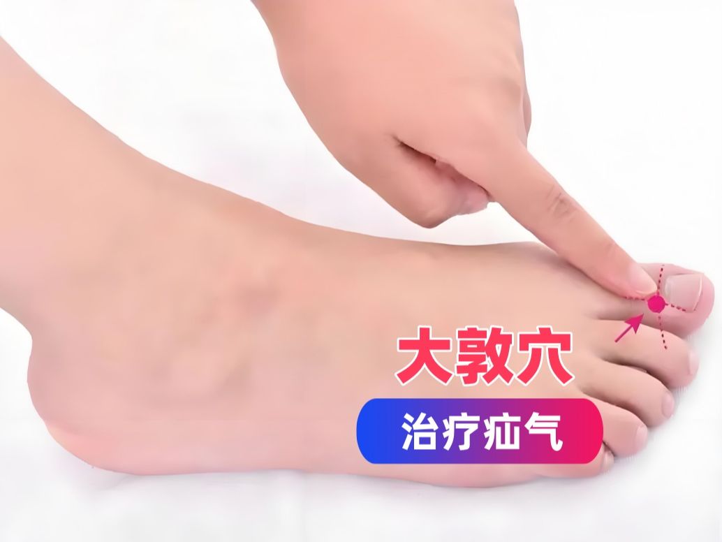 191、足厥阴肝经 — 大敦穴 — 治疗疝气