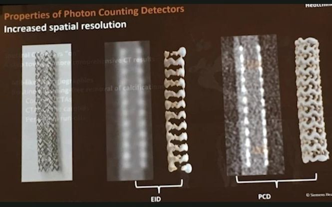 光子计数探测器CT(PCD-CT)
