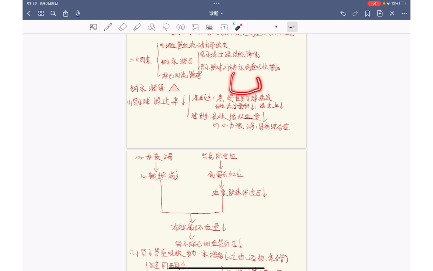 诊断学 水肿(钠水潴留,肾素 血管紧张素,醛固酮系统)