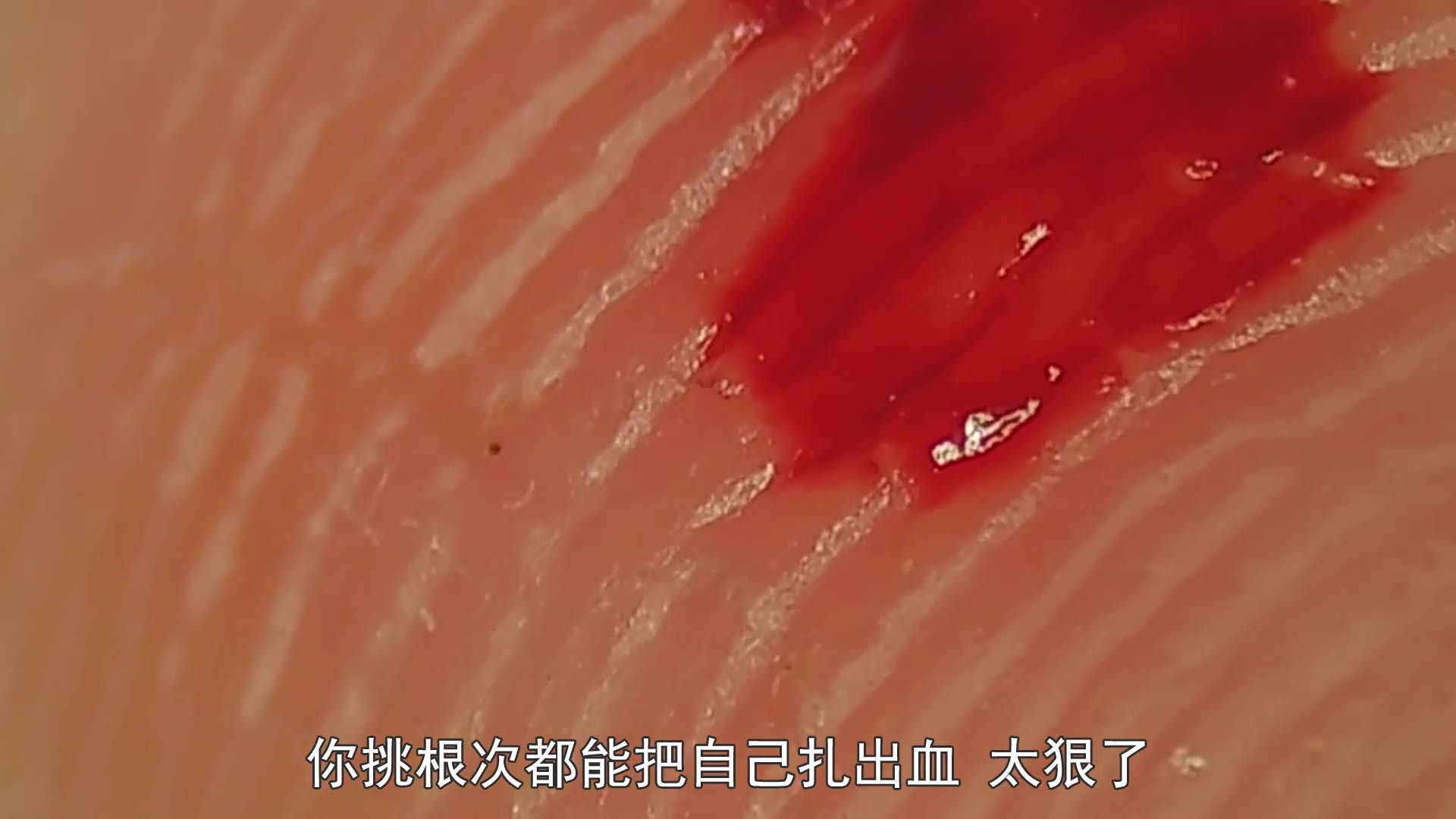 人体血液放大2000倍,无数个血细胞