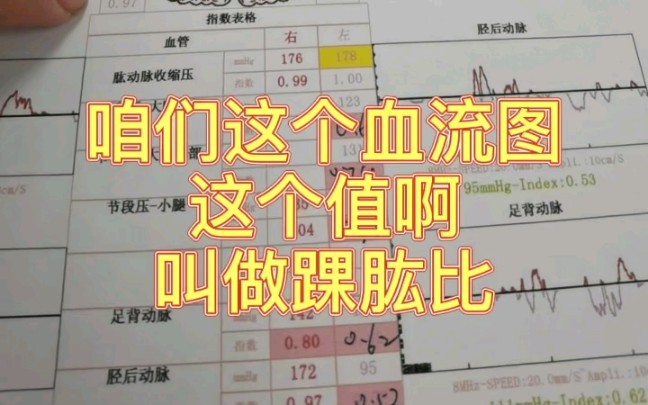 藏在血流图里的秘密:竟然发现腿疼腿麻可能是血管堵塞了!