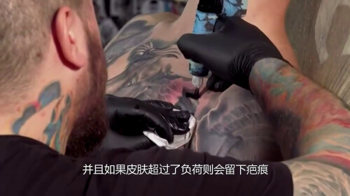 激光为什么能去除纹身?原来过程这么痛苦,光看都觉得疼