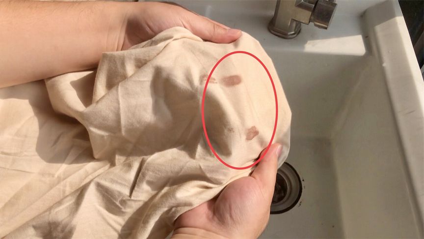 床单沾了血渍洗不掉,教你清洗妙招,新老血渍一洗就干净,太棒了
