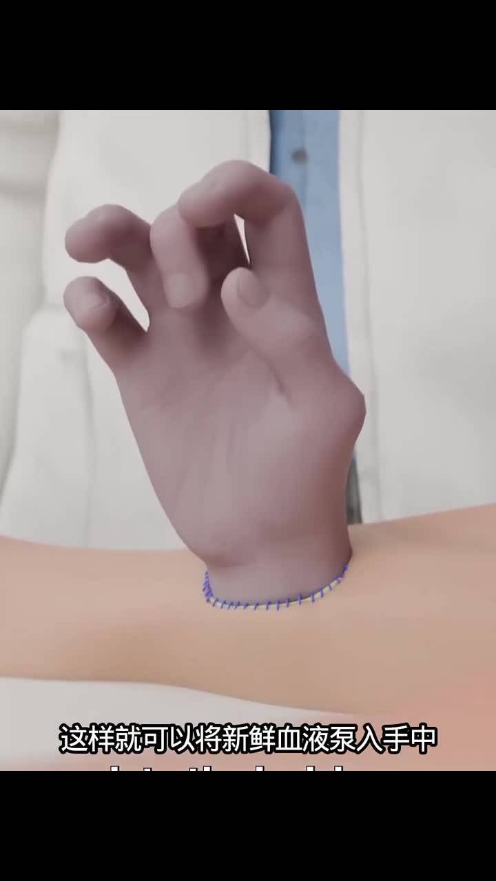 医生手把手解析血管构造