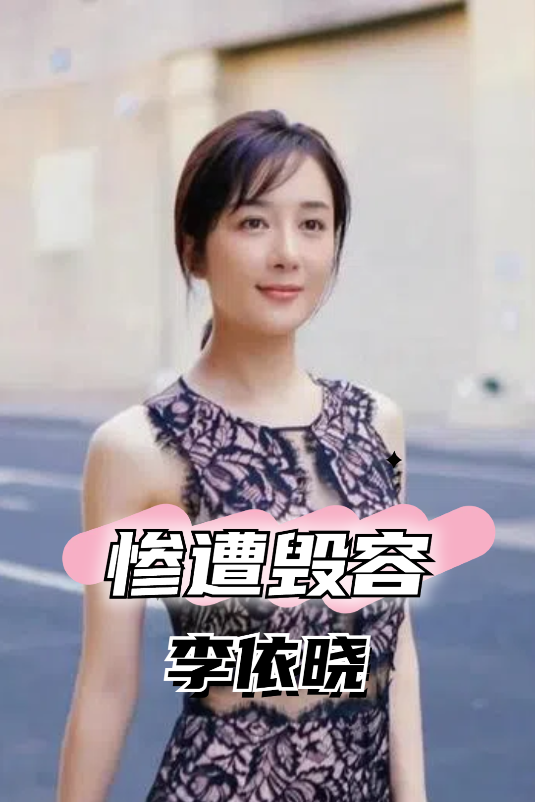 谁能想到,被狗咬毁容的李依晓如今被后遗症折磨的苦不堪言