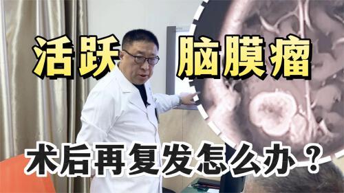 男子二级活跃脑膜瘤 不到一年再复发 主任:可以用伽玛刀照射