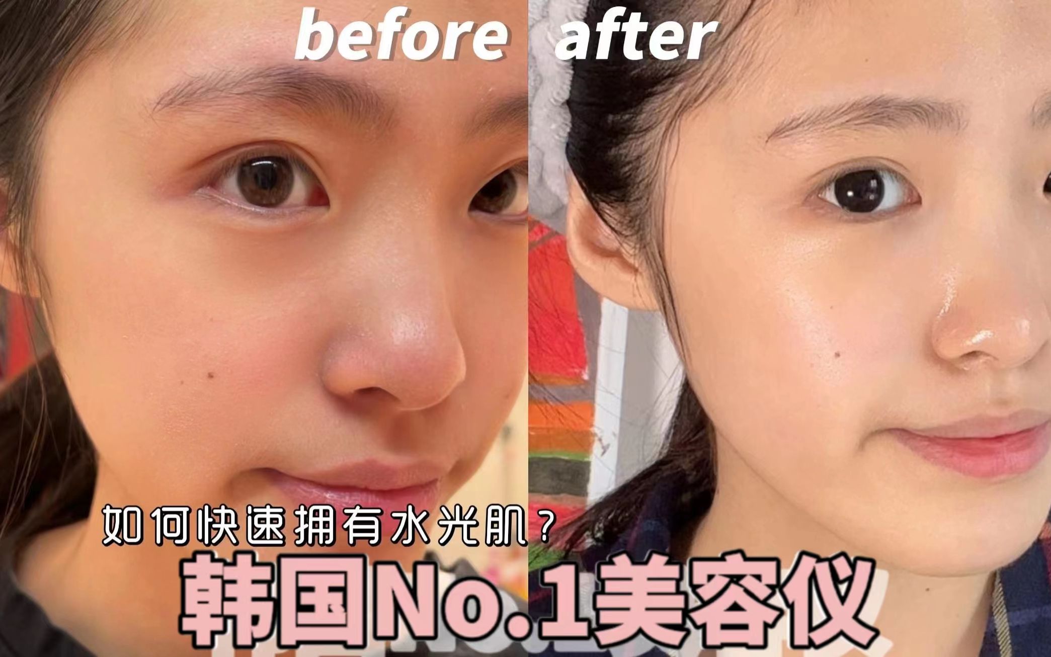 5分钟!再也不买美容仪了!这波赢大了!