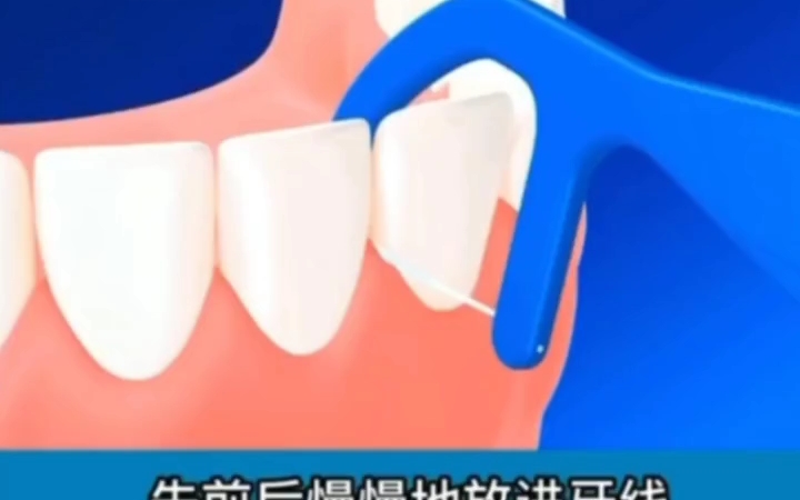牙线使用方法视频教程
