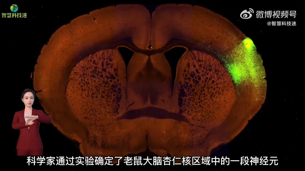 科学家发现管不住嘴神经元