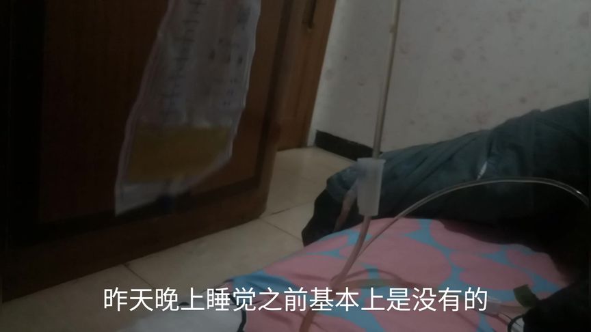 头疼!挂了25天的腹腔引流袋,一觉醒来发现腹腔积液又有200毫升