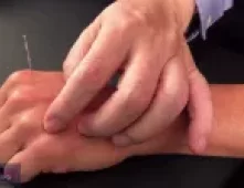 董氏针灸 王全民 22 部上白穴，中白穴，下白穴。