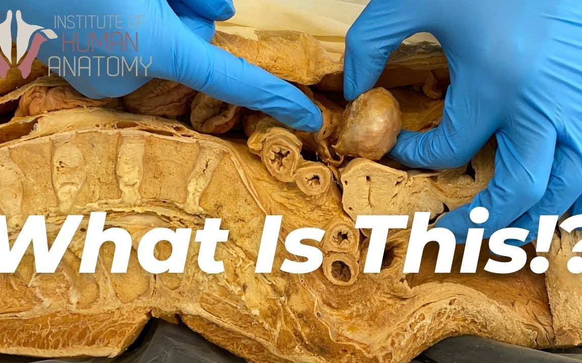 解剖实验室新到的大体老师 | 解剖老师的5个发现 | 双语字幕