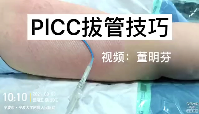 PICC拔管技巧