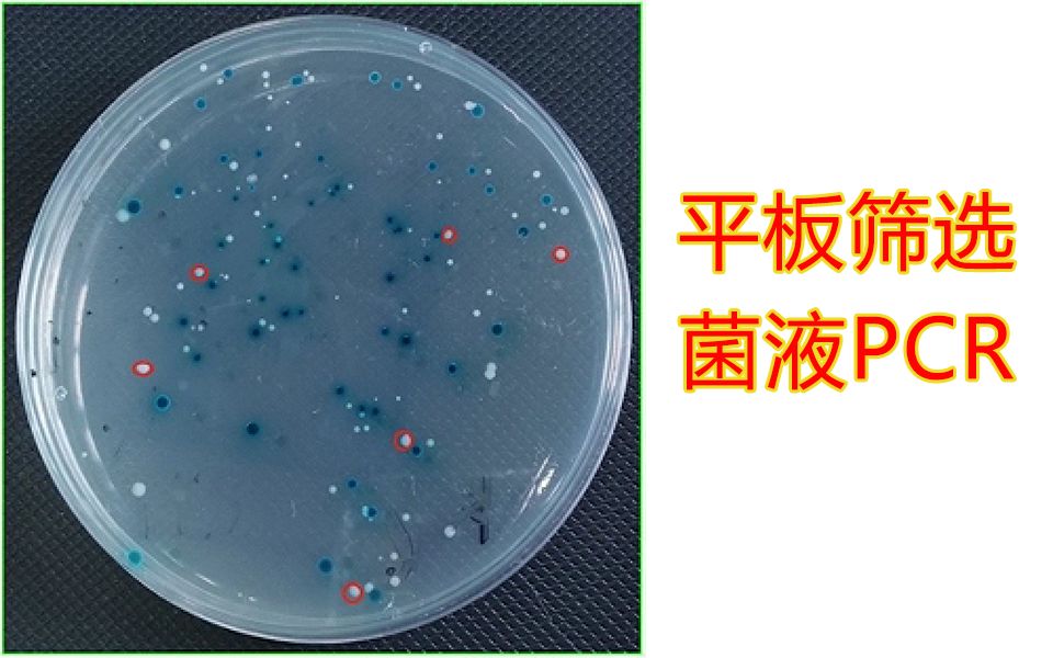 【实验】平板筛选,蓝白班筛选,菌液PCR操作