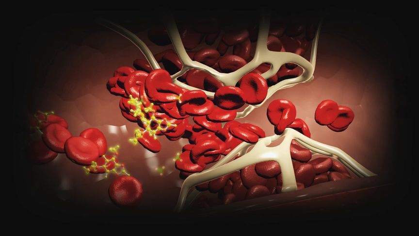 水蛭素抗凝溶栓过程