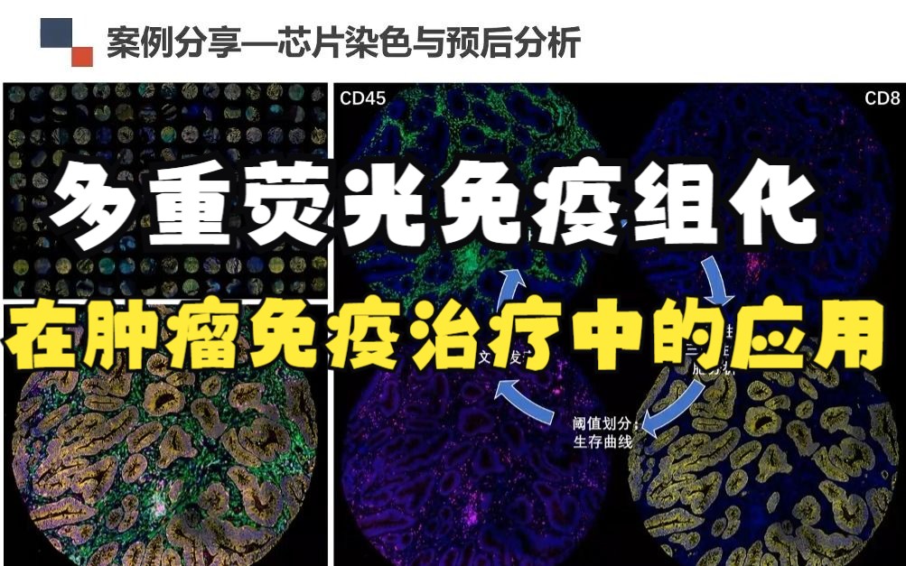 多重荧光免疫组化在肿瘤免疫治疗中的应用