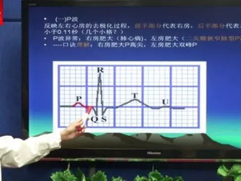 心电图速成讲授(2)