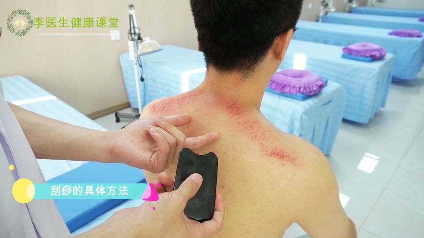 夏季刮痧好处多,专家教你如何正确刮痧,看完受益良多!