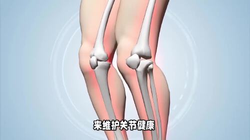 软骨素、氨糖、骨胶原,如何选择?