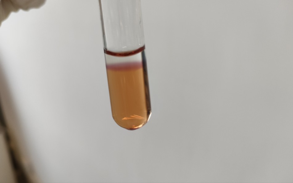 尿酮体定性实验