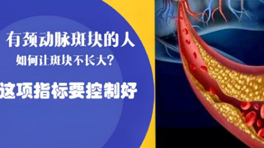 有颈动脉斑块的人,如何让斑块不长大?这项指标要控制好