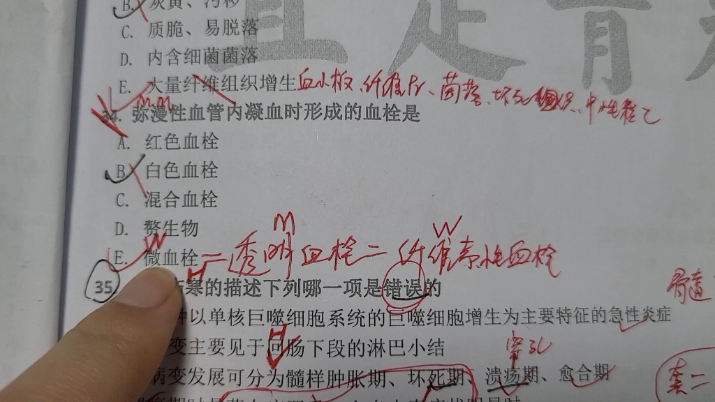 病理——弥漫性血管内凝血—透明血栓=微血栓=纤维素性血栓