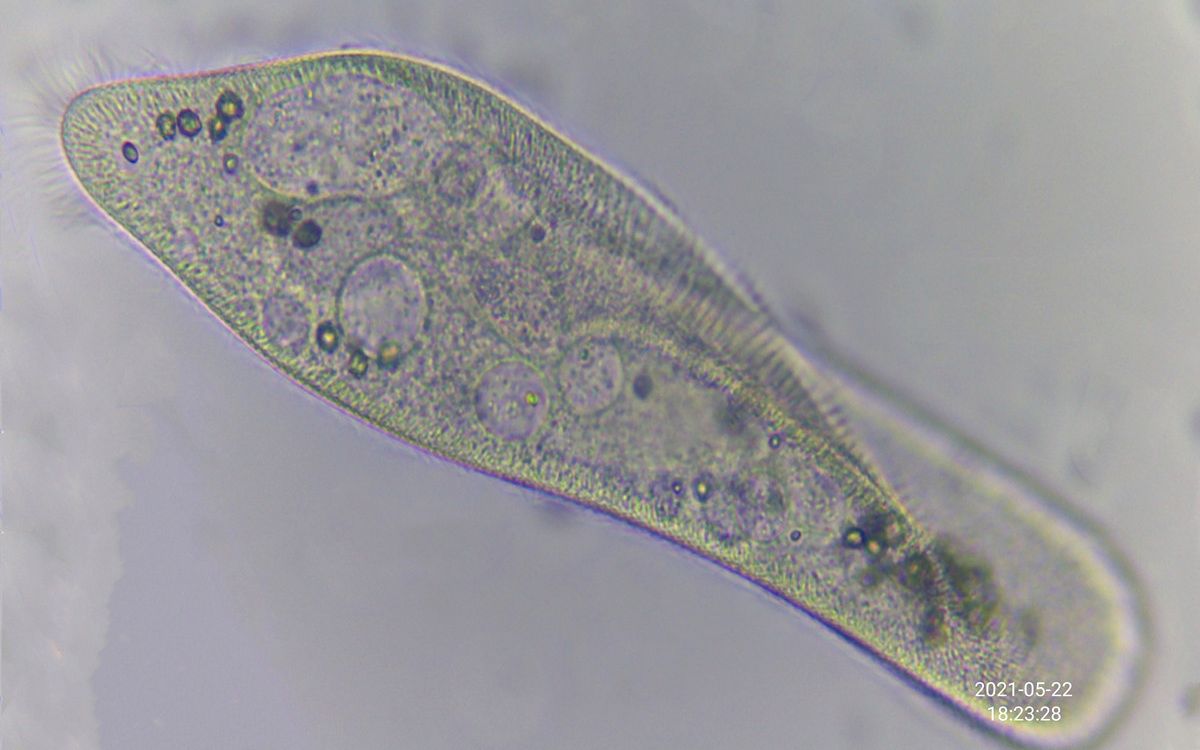 【科学实验】你知道草履虫是如何取食和排泄的吗?