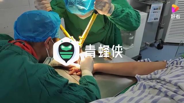 女子右手戴9枚戒指,食指被4枚戒指卡死肿胀医生无解求助消防