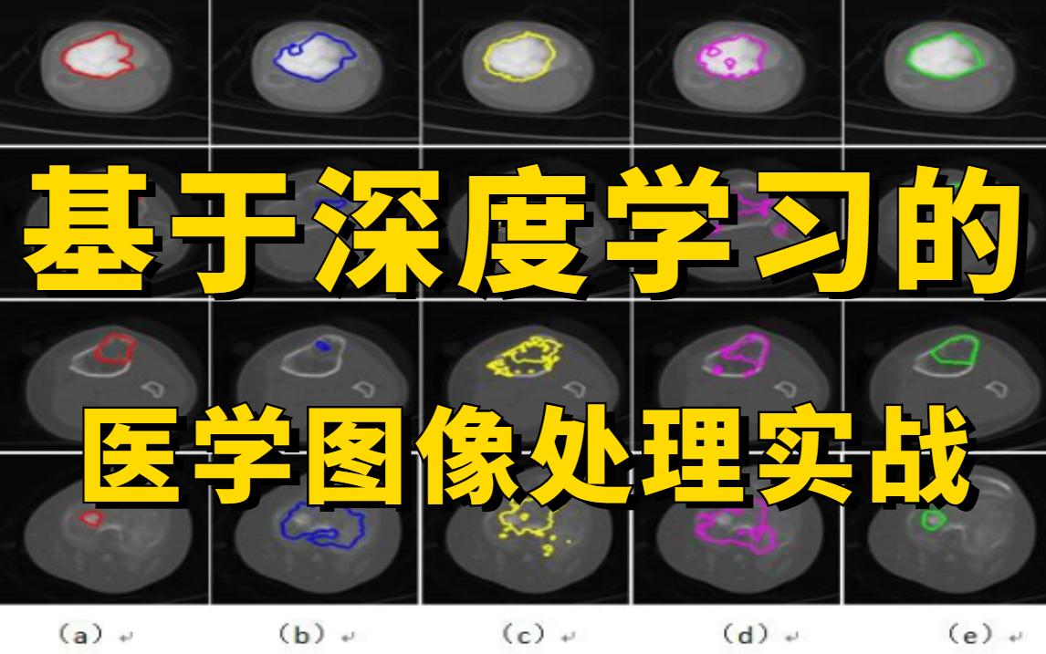 基于深度学习的医学图像处理实战:华理博士精讲医学图像分割+细胞...