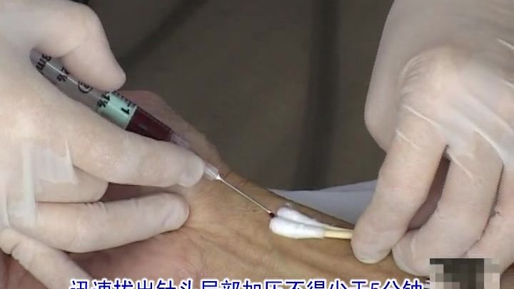 动脉穿刺术--临床医师技能操作