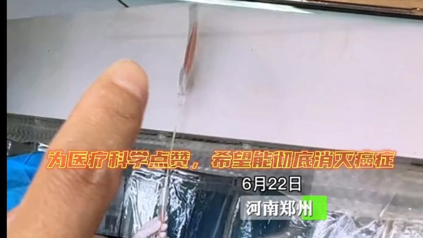 120万一针抗癌CAR-T治疗成功